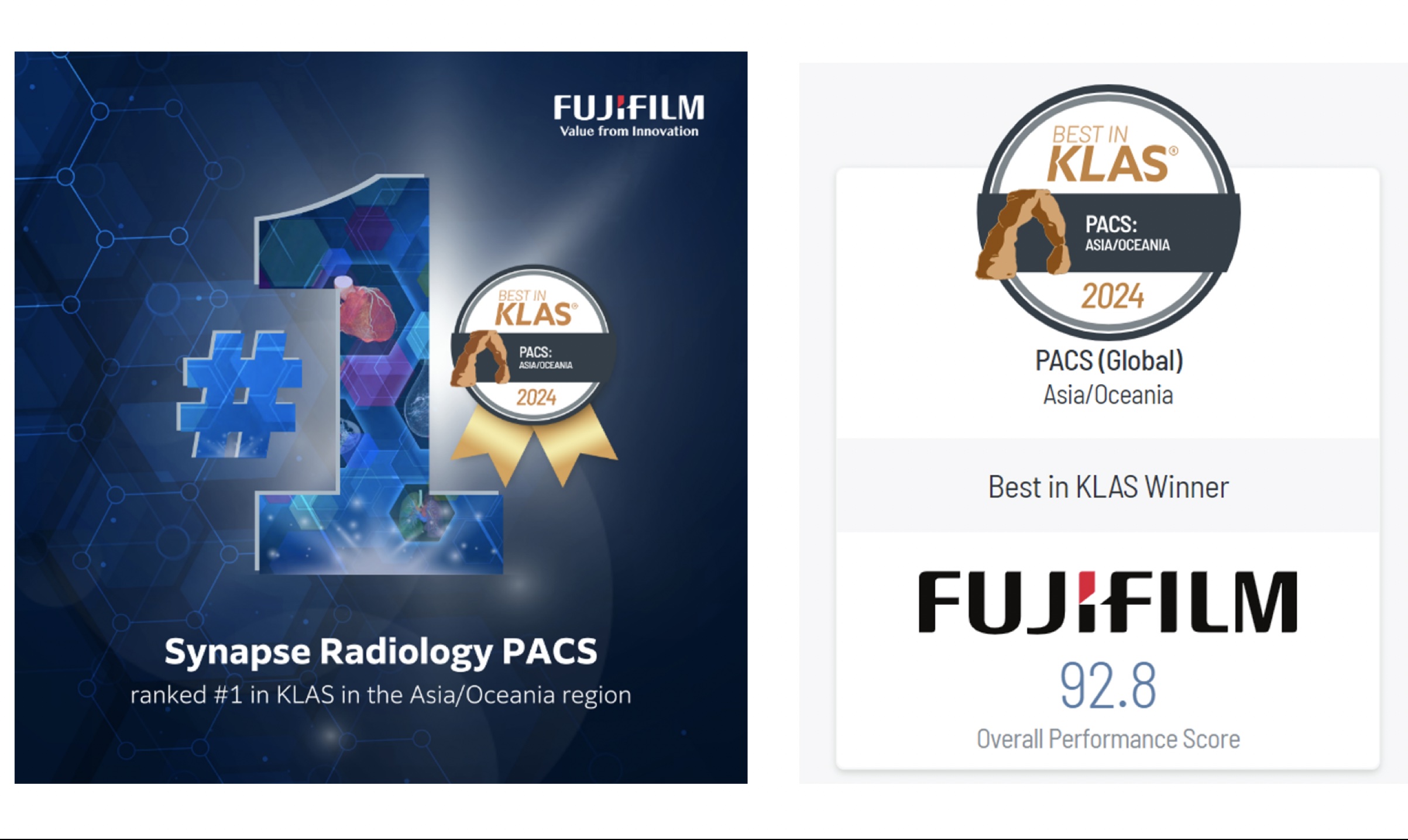 Synapse Radiology PACS ของฟูจิฟิล์ม ได้รับรางวัลระดับภูมิภาค